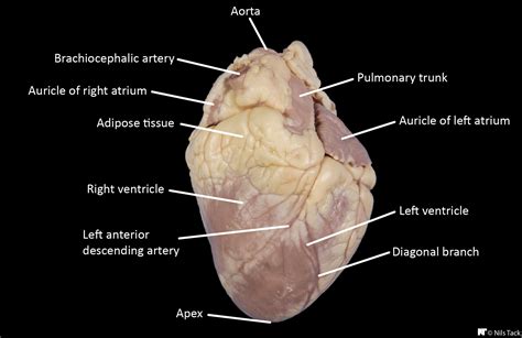 Heart Dissection Labeled - King Ice Apps